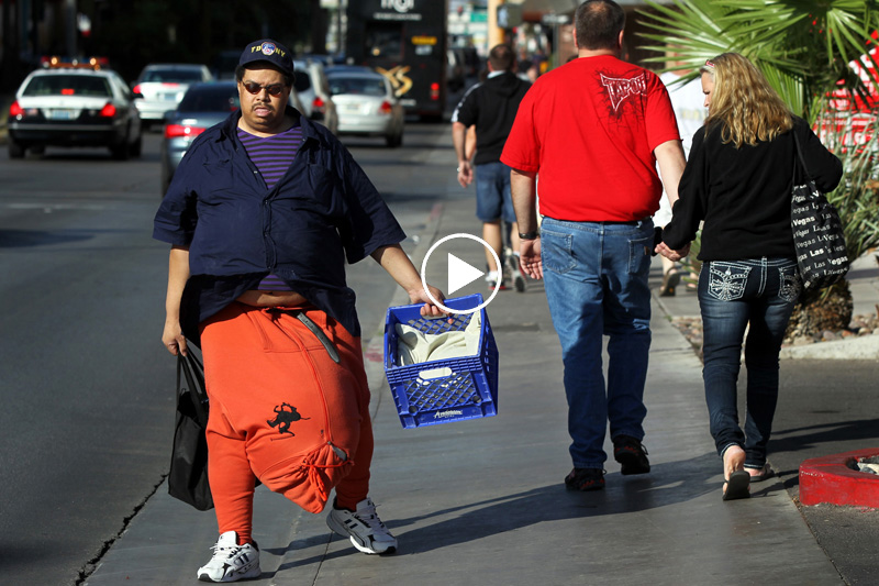 Wesley Warren Scrotal Lymphedema