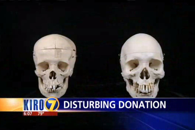 Someone donated 3 human skulls to Goodwill | Uncategorized