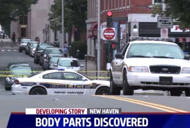 Severed arms, legs found near Connecticut train station | Uncategorized