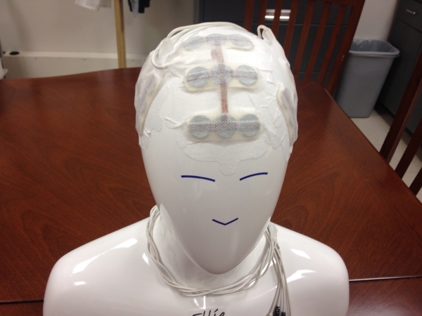 New treatment helps extend survival for brain tumor patients | Las ...