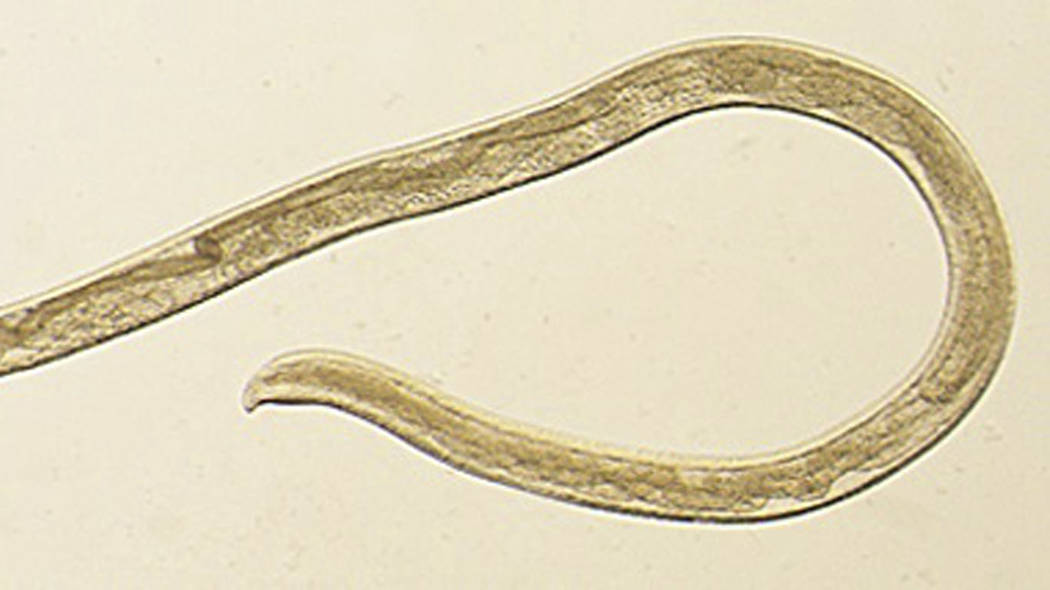 Rare infection causes 14 worms to come out of Oregon woman’s eye | Las ...