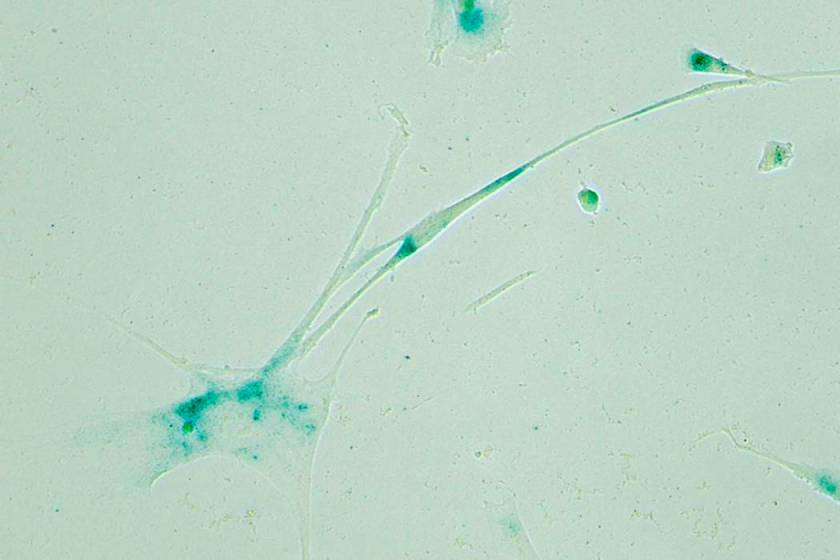 ‘Zombie’ cells may play vital role in aging process | Las Vegas Review ...