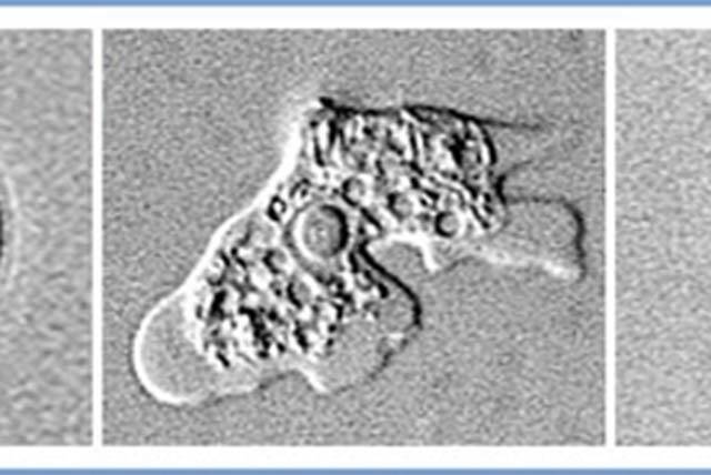 Brain-eating amoeba suspected in Nevada hot spring after person’s death ...